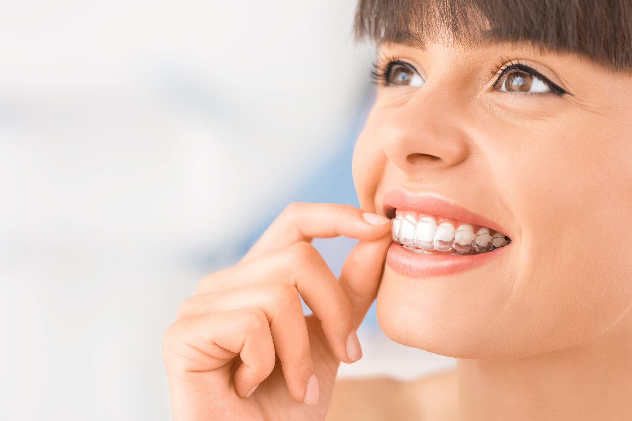 How Are Braces Put On? Everything You Need To Know - Dentistry at ...