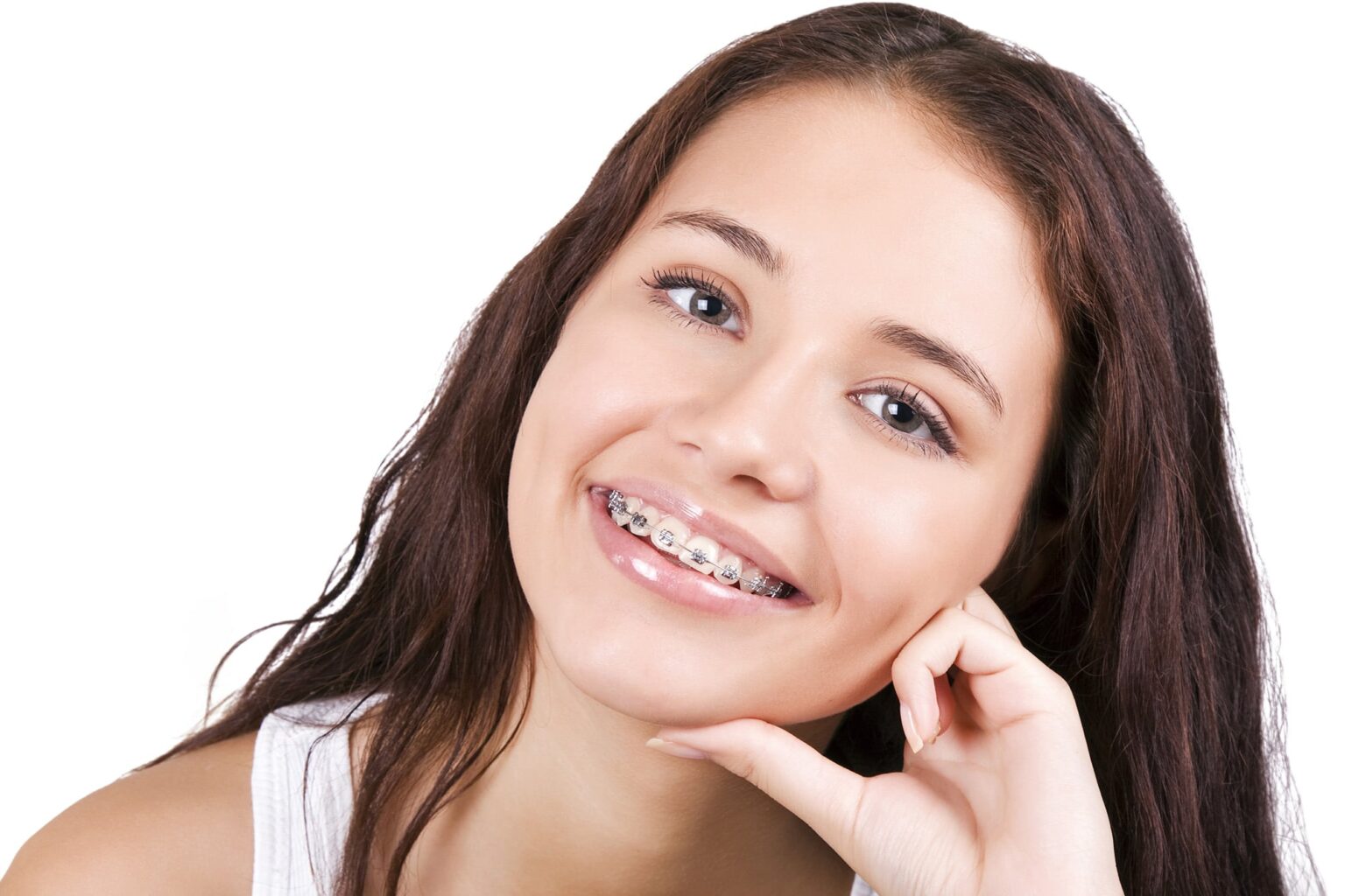 How Are Braces Put On? Everything You Need To Know - Dentistry at ...